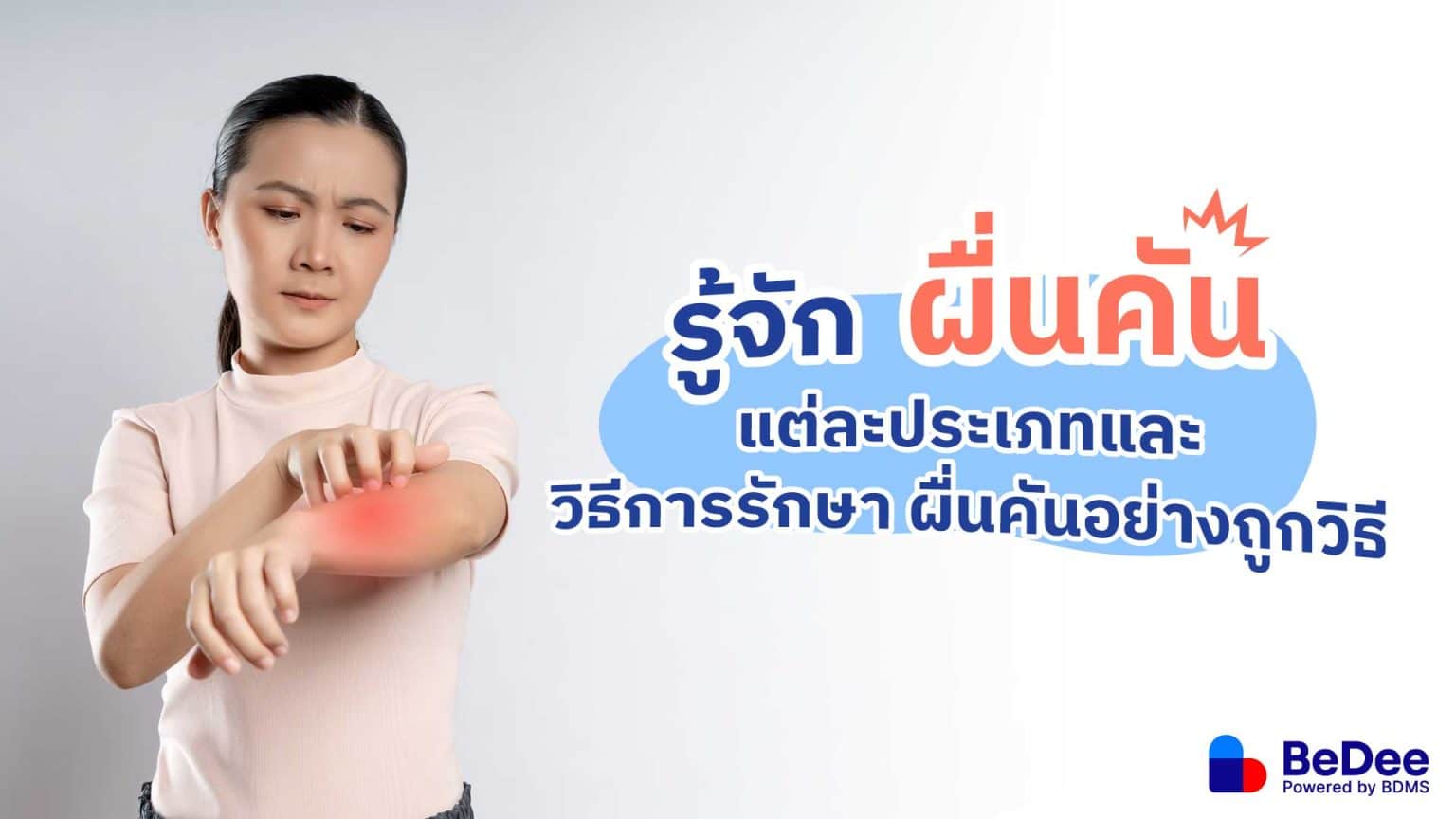 รู้จัก “ผื่นคัน” ประเภทต่าง ๆ และวิธีรักษาผื่นคัน - BeDee