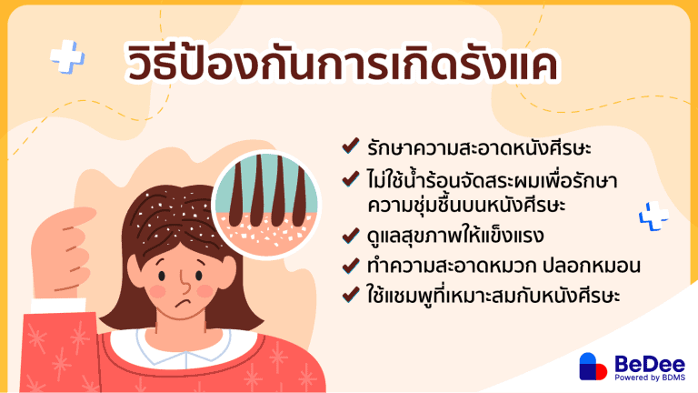 รังแค (Dandruff) เกิดจากอะไร พร้อม 5 วิธีรักษาและขจัดรังแค - BeDee