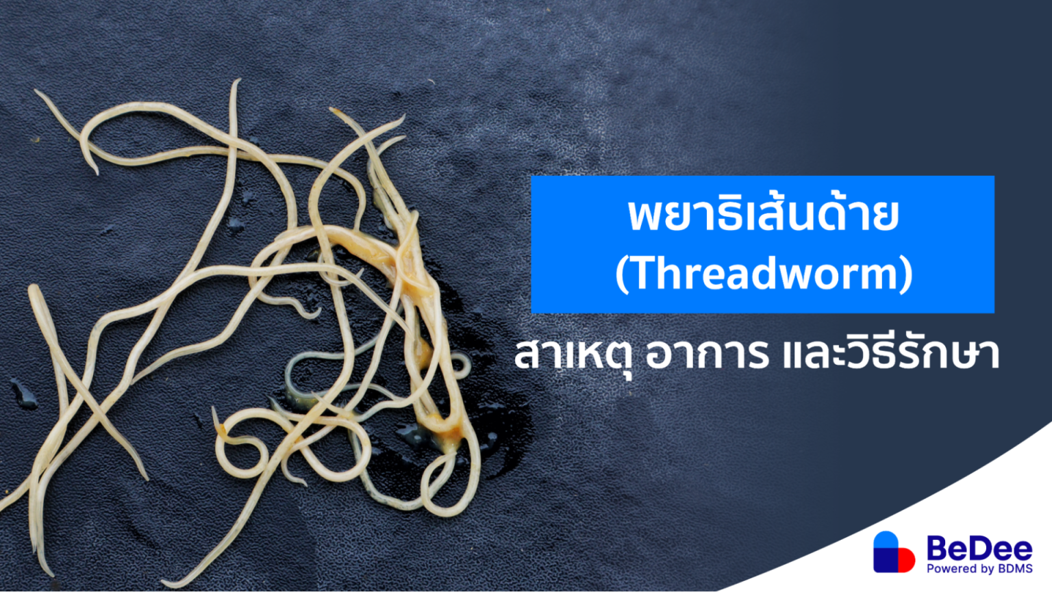 พยาธิเส้นด้าย (Threadworm) เรียนรู้สาเหตุ อาการ และวิธีรักษา - BeDee